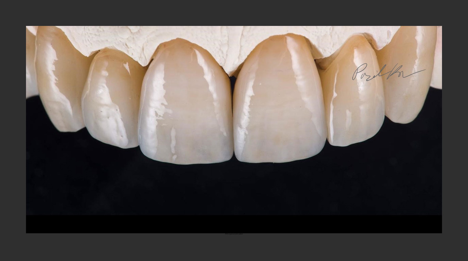 MIYO - AGC New Dent